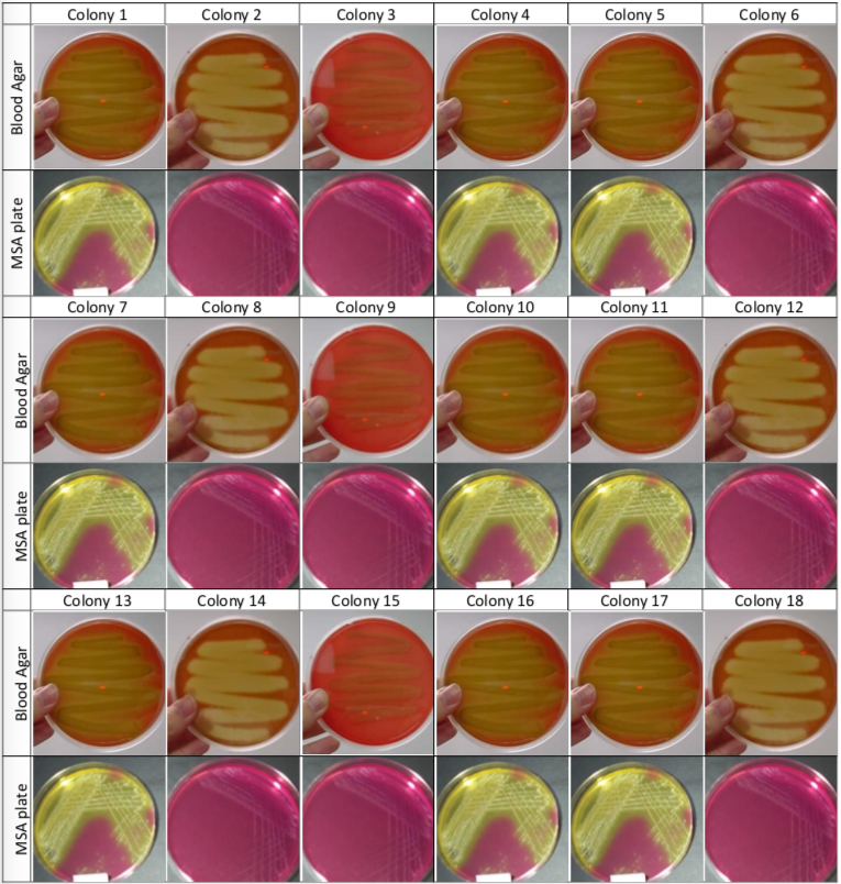 Solved After observing the results from the blood agar and | Chegg.com