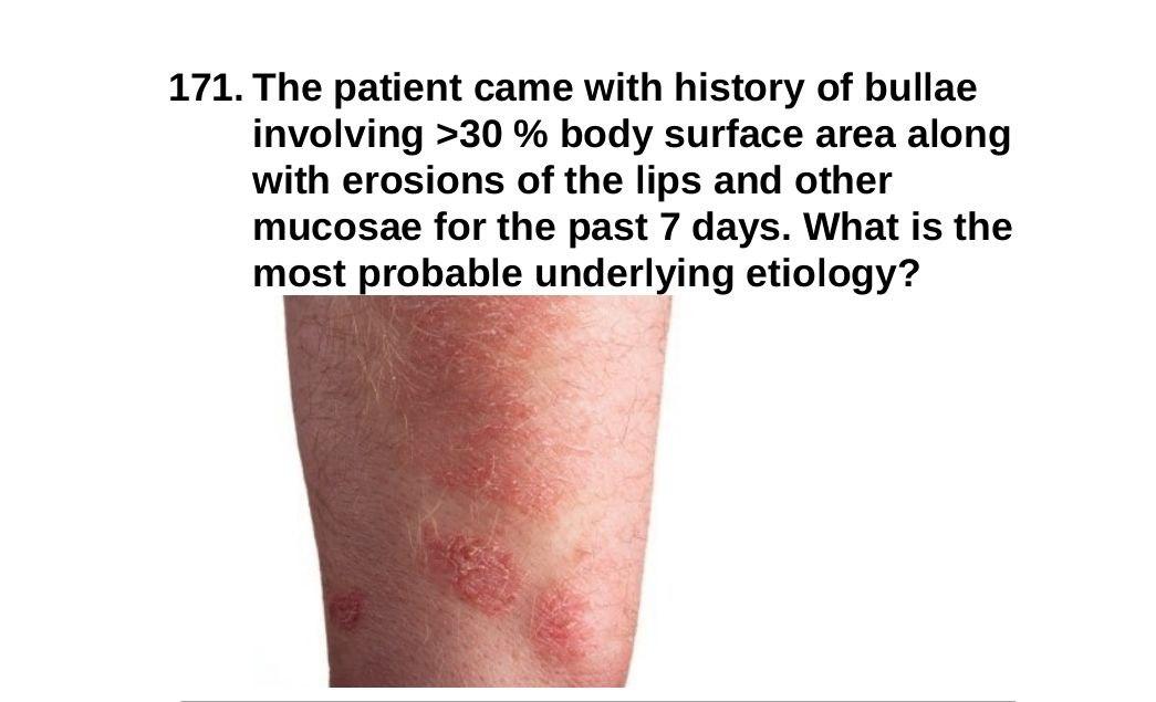 Solved 171. The patient came with history of bullae | Chegg.com