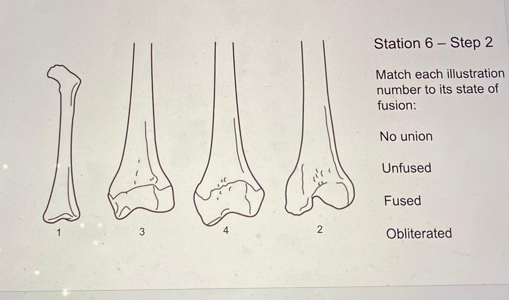 Solved Station 6 - Step 2 Match each illustration number to | Chegg.com