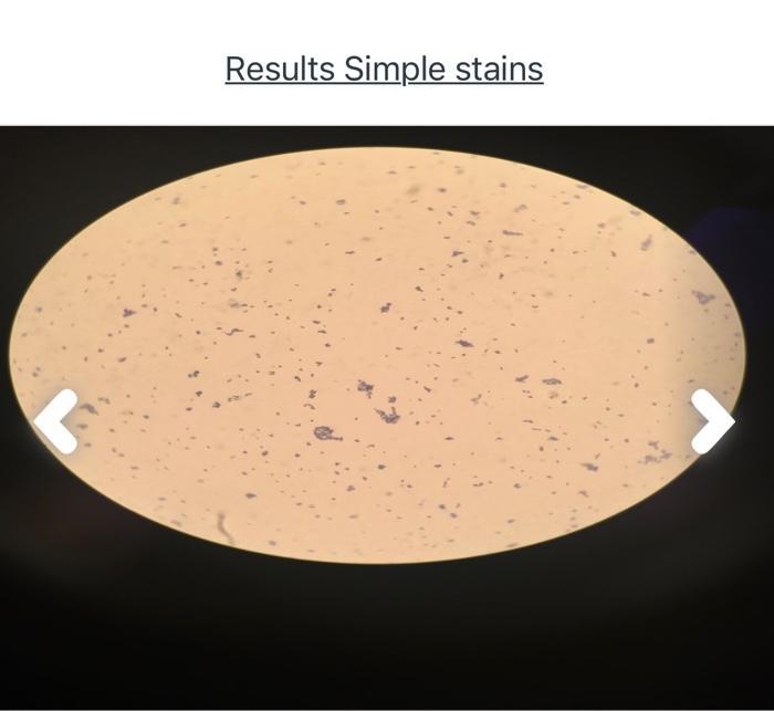 Solved Simple stain procedure: •Simple stain •Smears from | Chegg.com