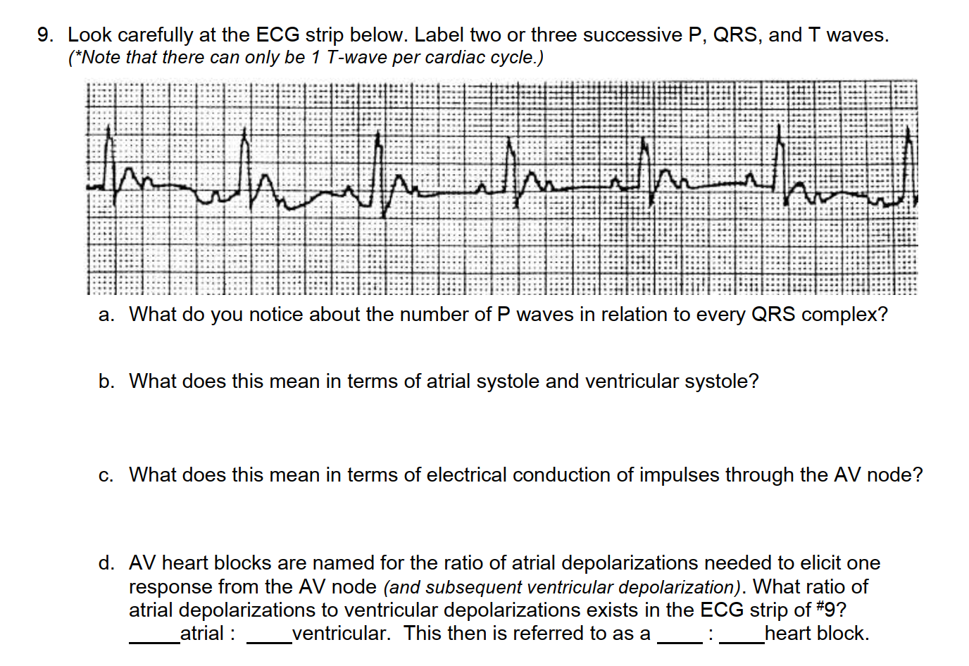 Solved 9. Look carefully at the ECG strip below. Label two | Chegg.com