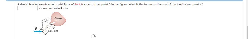 Solved A dental bracket exerts a horizontal force of 76.4 N | Chegg.com