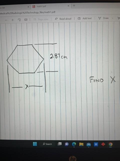 Solved FIND X | Chegg.com