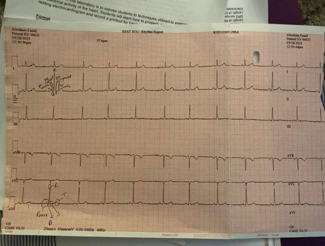Solved 8 Interpret Your Ecg Printout Using The Same
