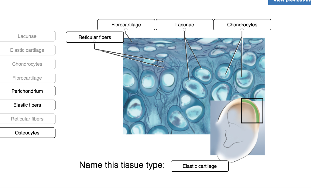 Solved Vlew previous atten Simple Simple squamous | Chegg.com