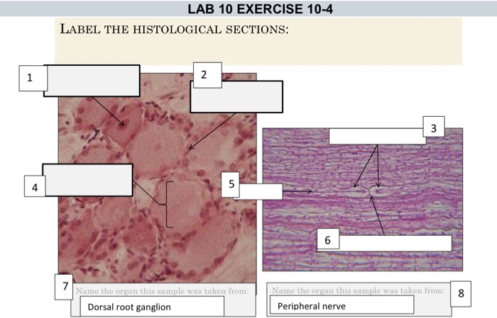 LAB 10 EXERCISE 10-4 LABEL THE HISTOLOGICAL SECTIONS: | Chegg.com