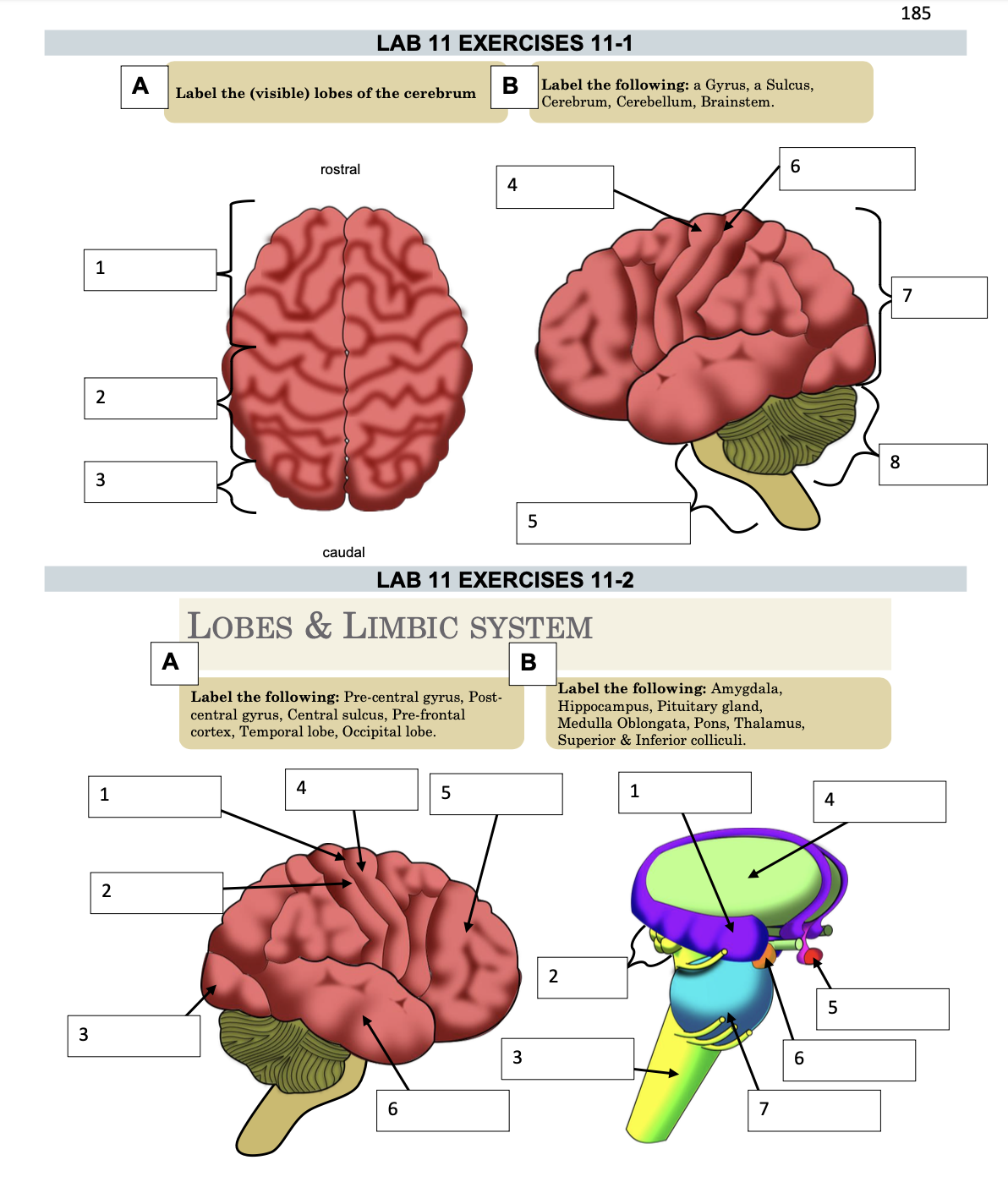 Solved 185 LAB 11 EXERCISES 11-1 A Label the (visible) lobes | Chegg.com