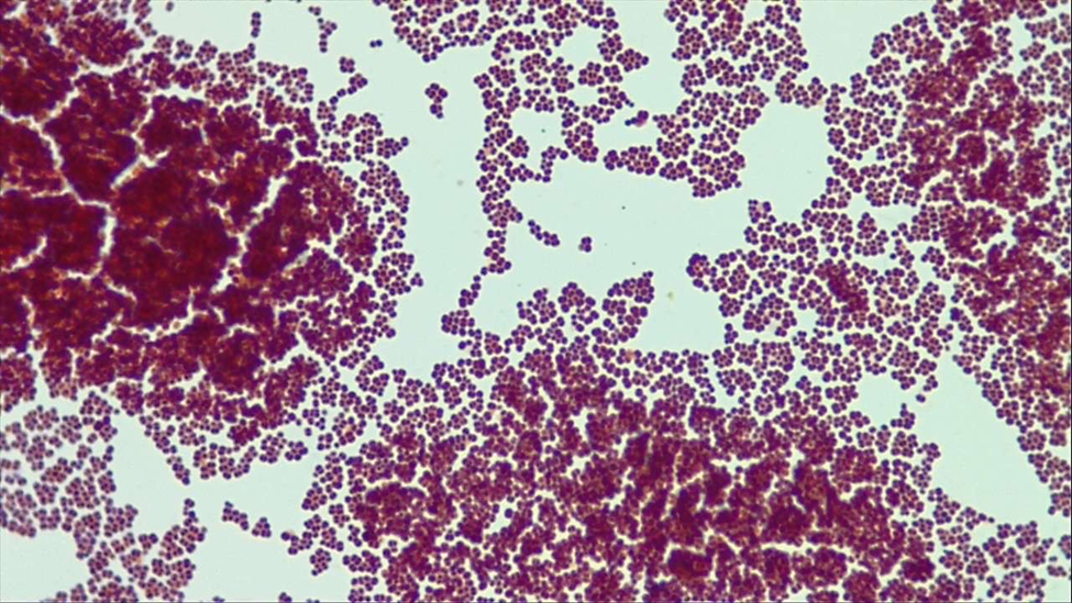 Gram Stain Unknown #47C 1.) What can be the unknown? | Chegg.com