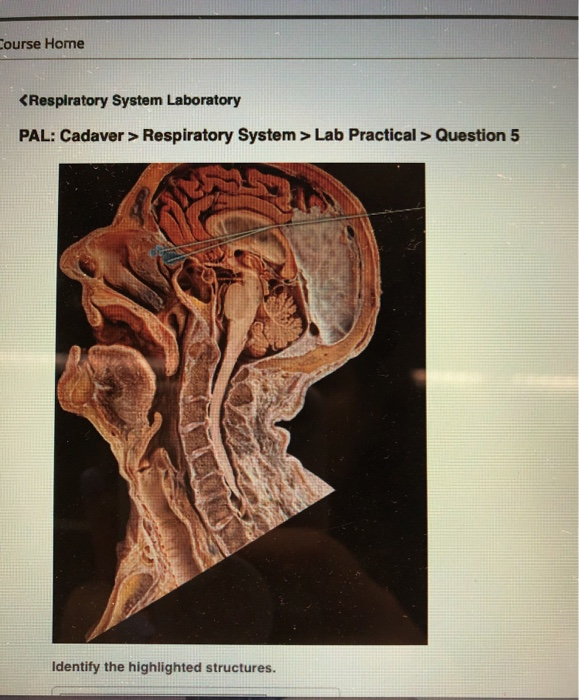 Solved Course Home Respiratory System > Lab | Chegg.com