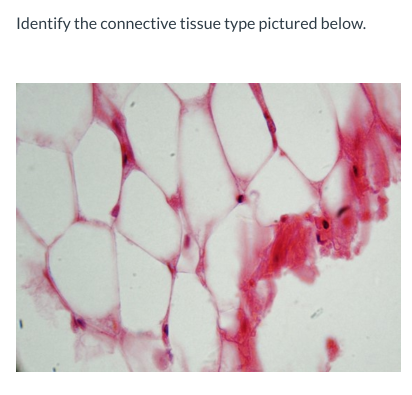 Solved Identify the epithelial tissue type pictured below. 及 | Chegg.com Solved Identify the epithelial tissue type pictured below. 及 | Chegg.com