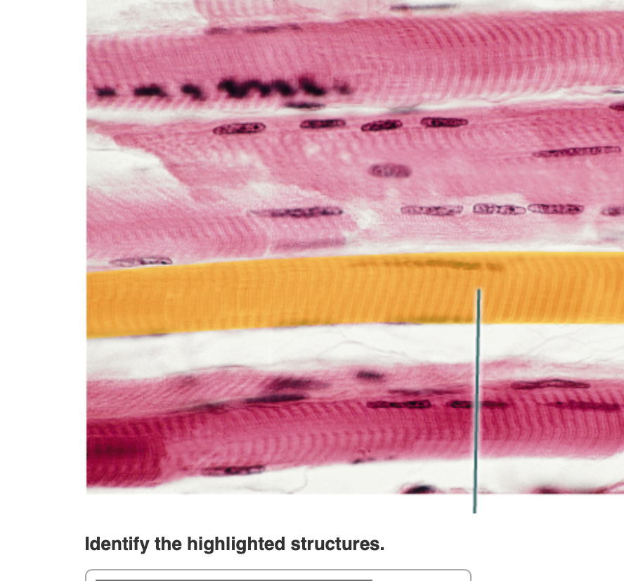 Solved Identify the highlighted structures. | Chegg.com Solved Identify the highlighted structures. | Chegg.com