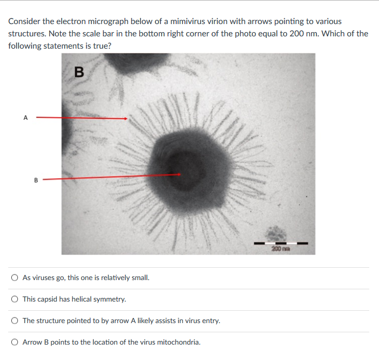 Solved Consider the electron micrograph below of a mimivirus | Chegg.com