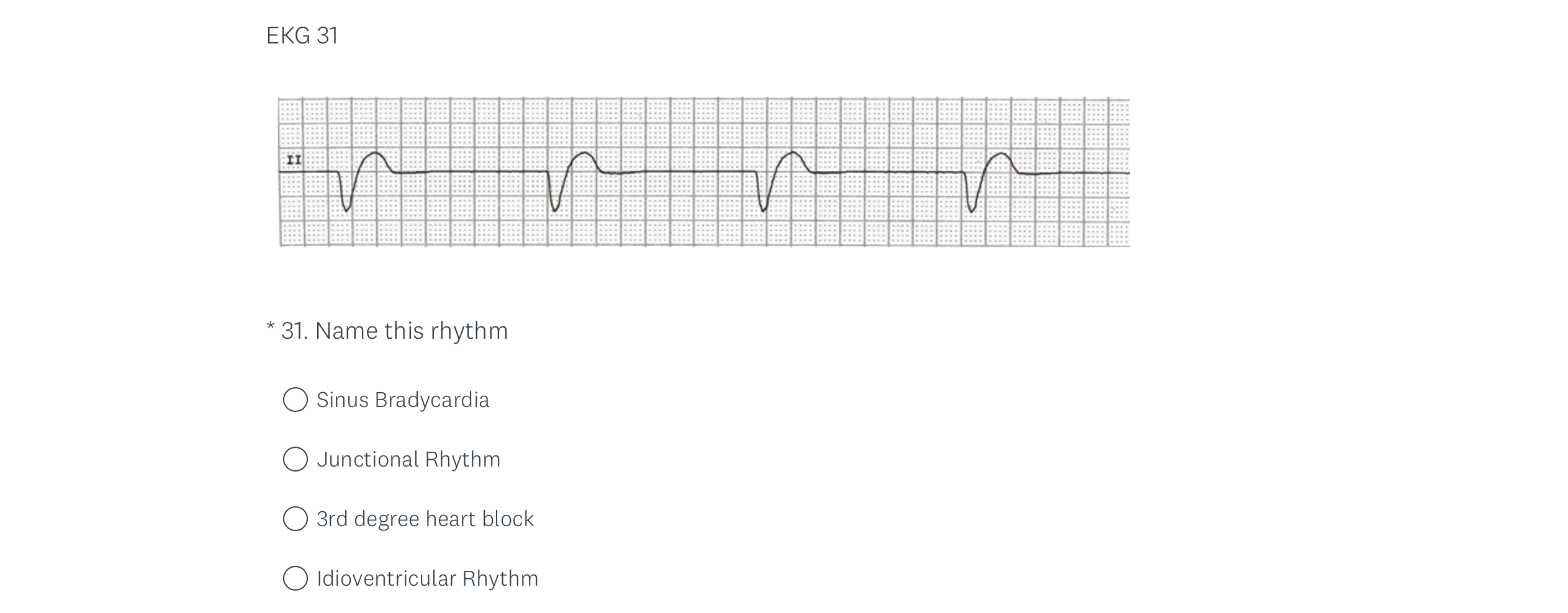 Solved Use the EKG strips to answer the questions below each | Chegg.com