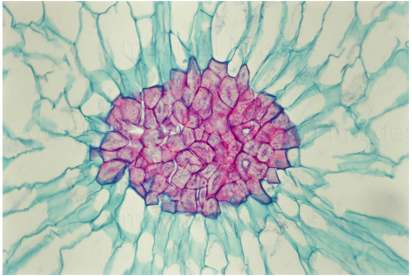 Solved Either draw or describe the appearance of pear cells; | Chegg.com