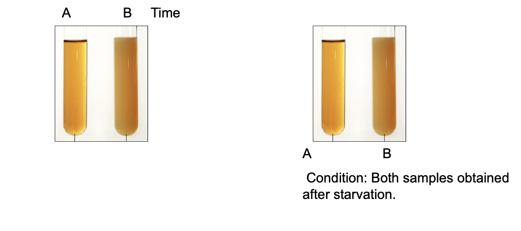 Solved 1a.Following is the plasma sample from two people: | Chegg.com