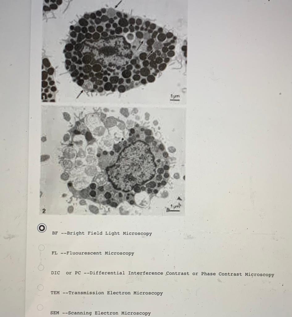 Solved Examine this micrograph examining the synapse between | Chegg.com