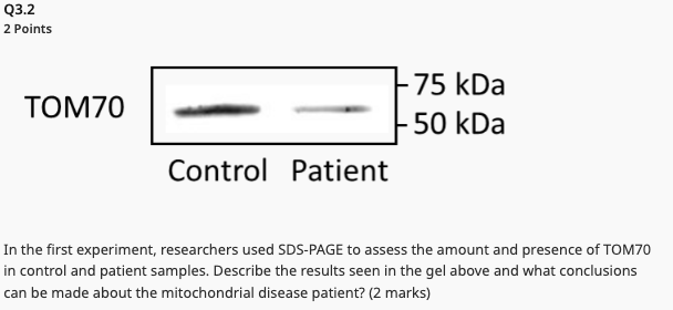 Solved Q3.22 ﻿Points ﻿TOM70 {:[-75kDa] Control Patient In | Chegg.com