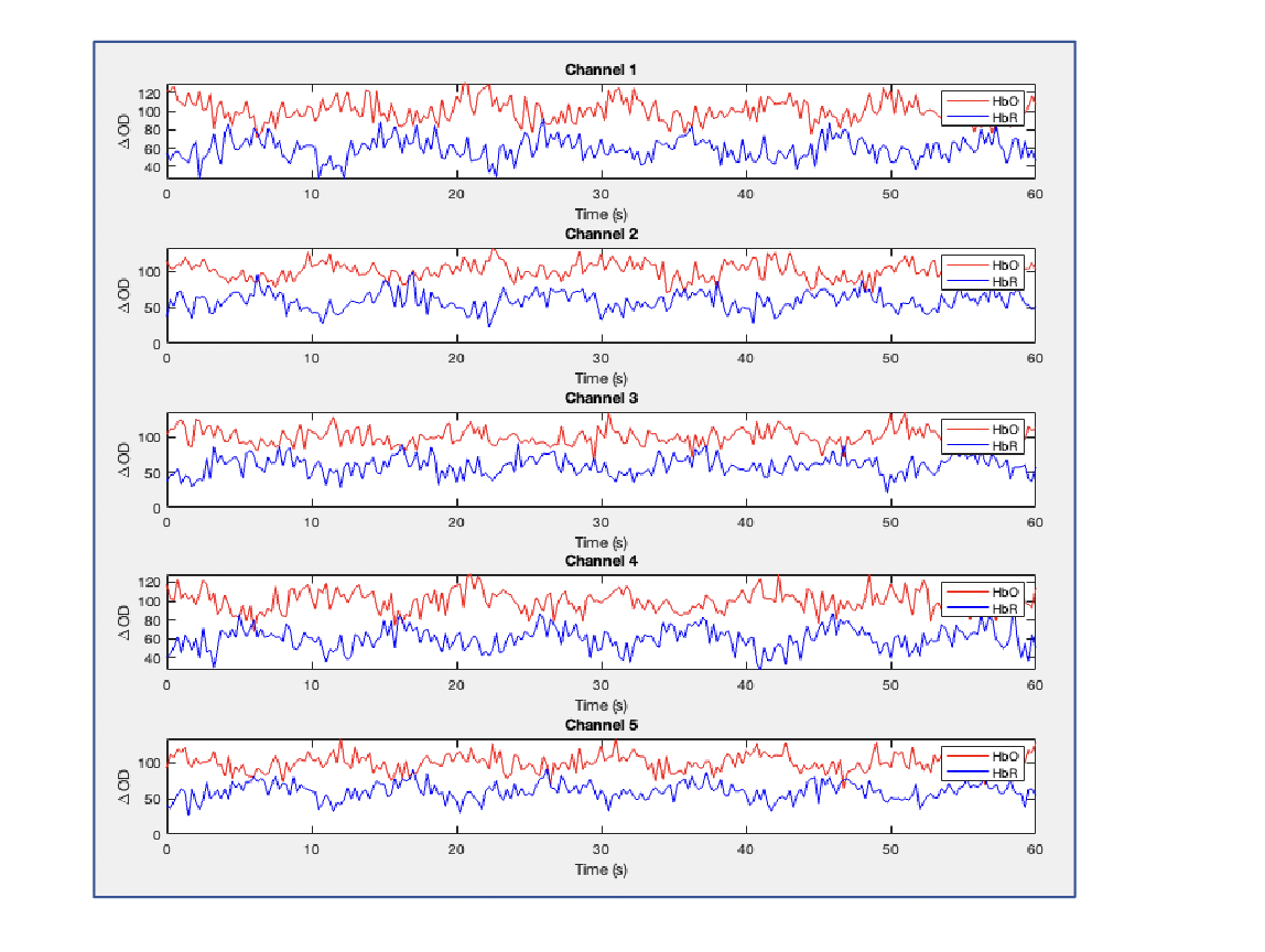 Solved 3 Generate Synthetic Fnirs Data By Simulating