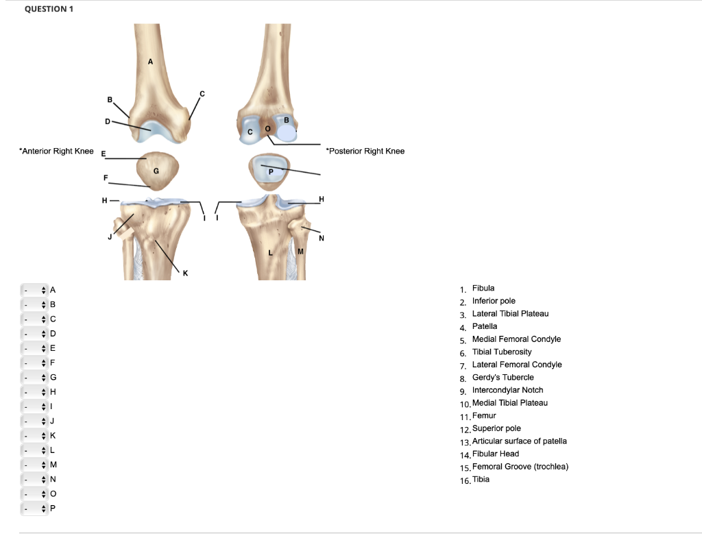 Intercondylar Notch Femur