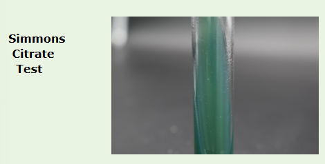 Solved Simmons Citrate Test | Chegg.com