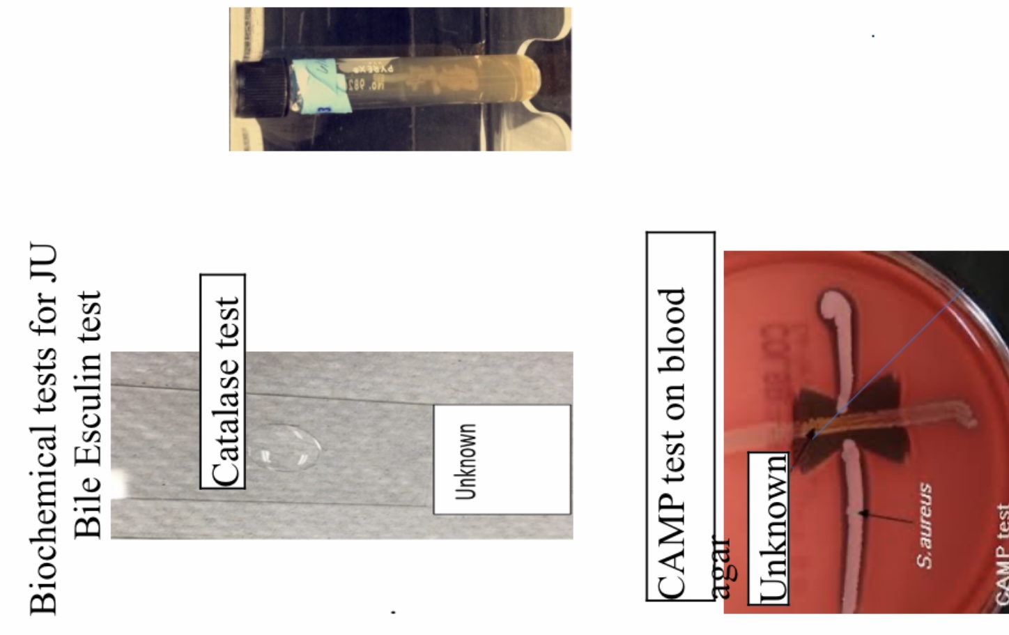 Solved JU - Colony Morphology Biochemical tests for JU Bile | Chegg.com