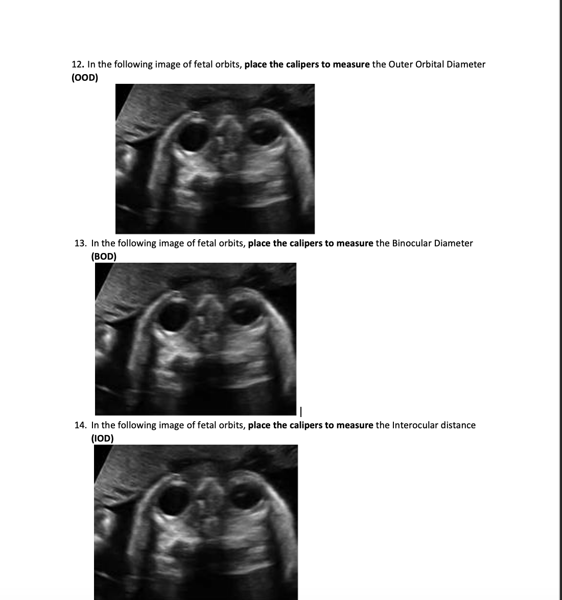 Solved In the following image of fetal orbits, place the | Chegg.com
