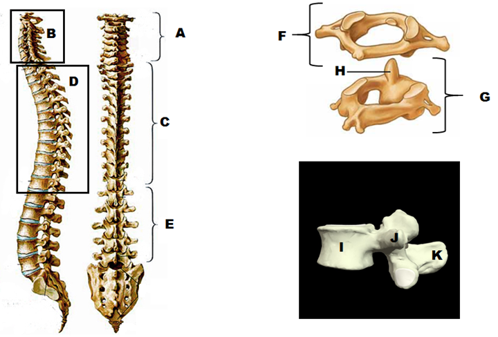 Solved 1. Spinous process 2. Lumbar | Chegg.com