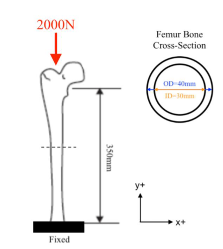Solved A 350mm long femur bone with a Young’s Modulus of E = | Chegg.com