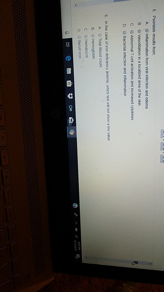 Solved EC demauts may be caused by A OViral infections or a | Chegg.com