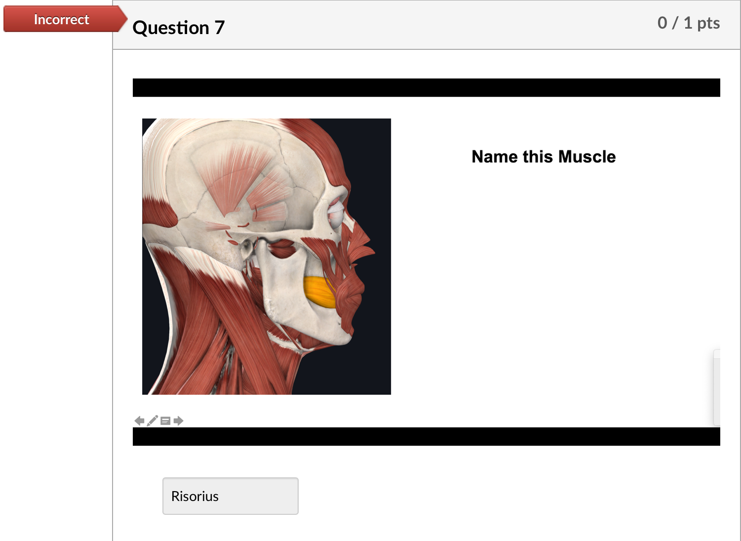 Solved Name this Muscle Name this Muscle | Chegg.com