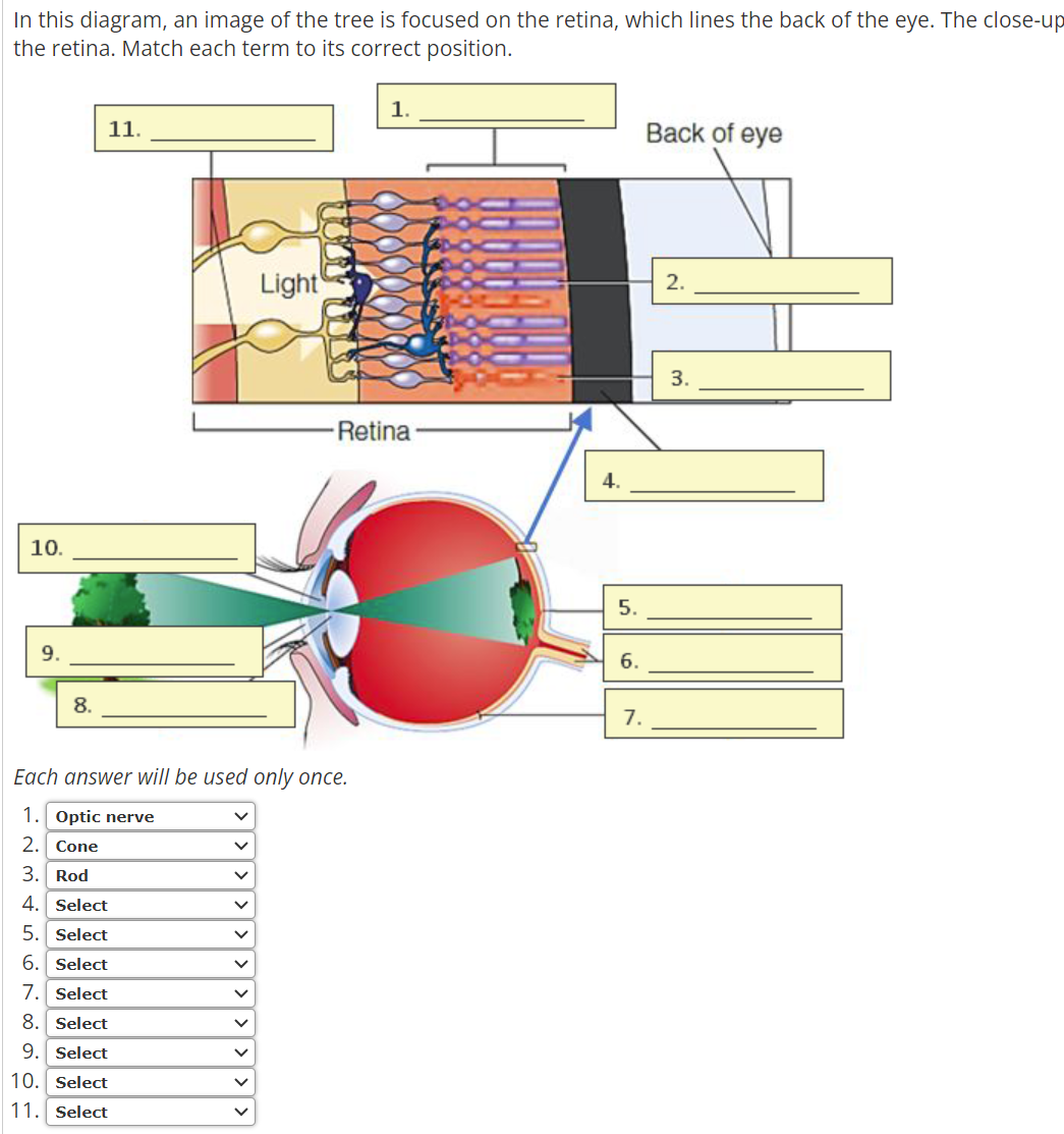 Solved In this diagram, an image of the tree is focused on | Chegg.com