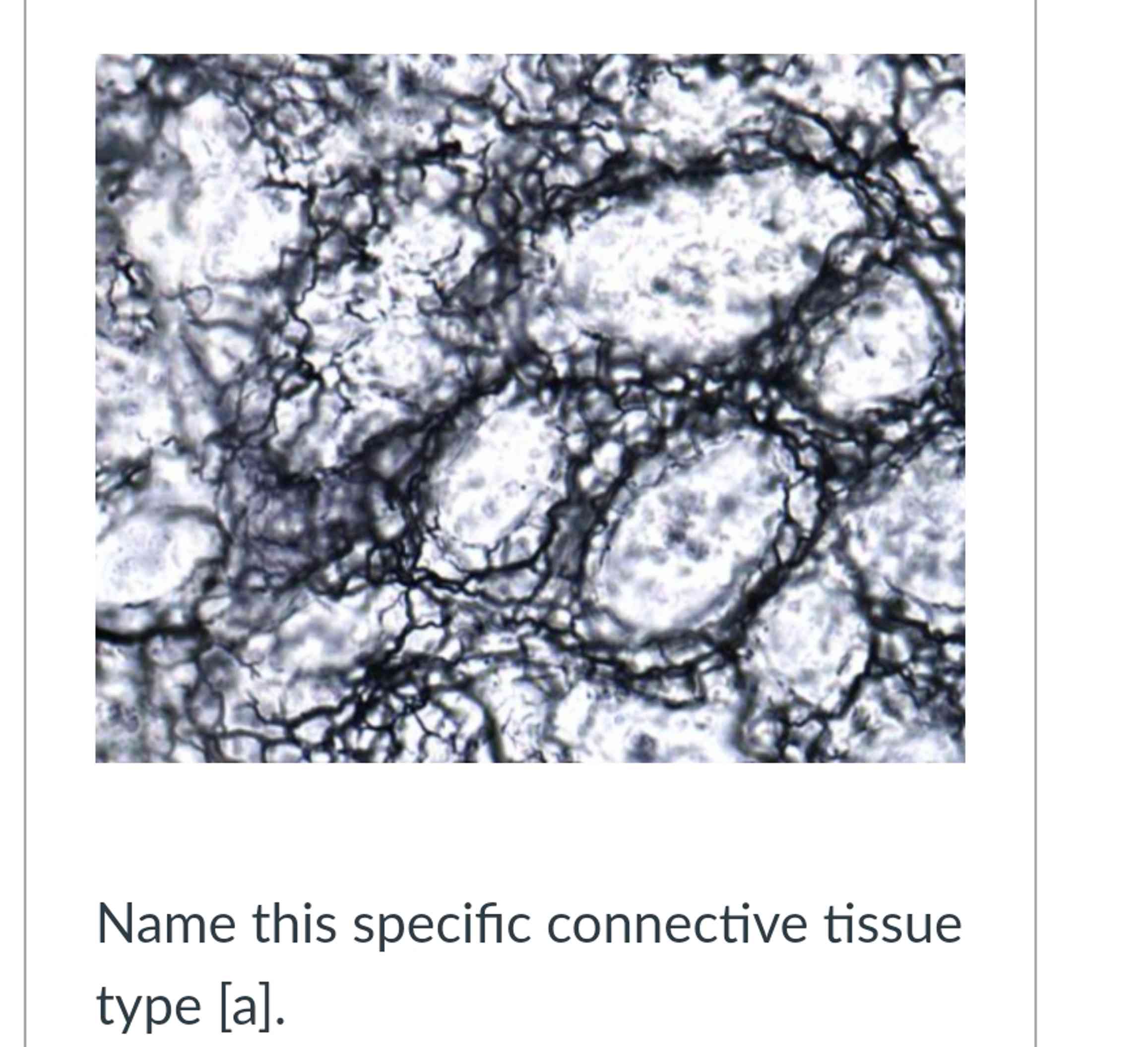 Solved Name this specific connective tissuetype | Chegg.com