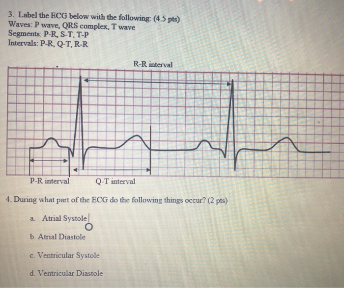 Solved 3. Label the ECG below with the following: (4.5 pts) | Chegg.com
