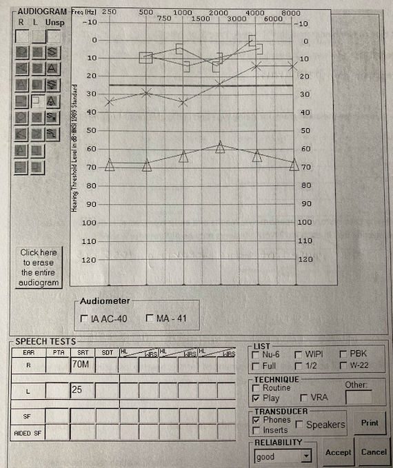 Solved Can I get some help with describing the type | Chegg.com