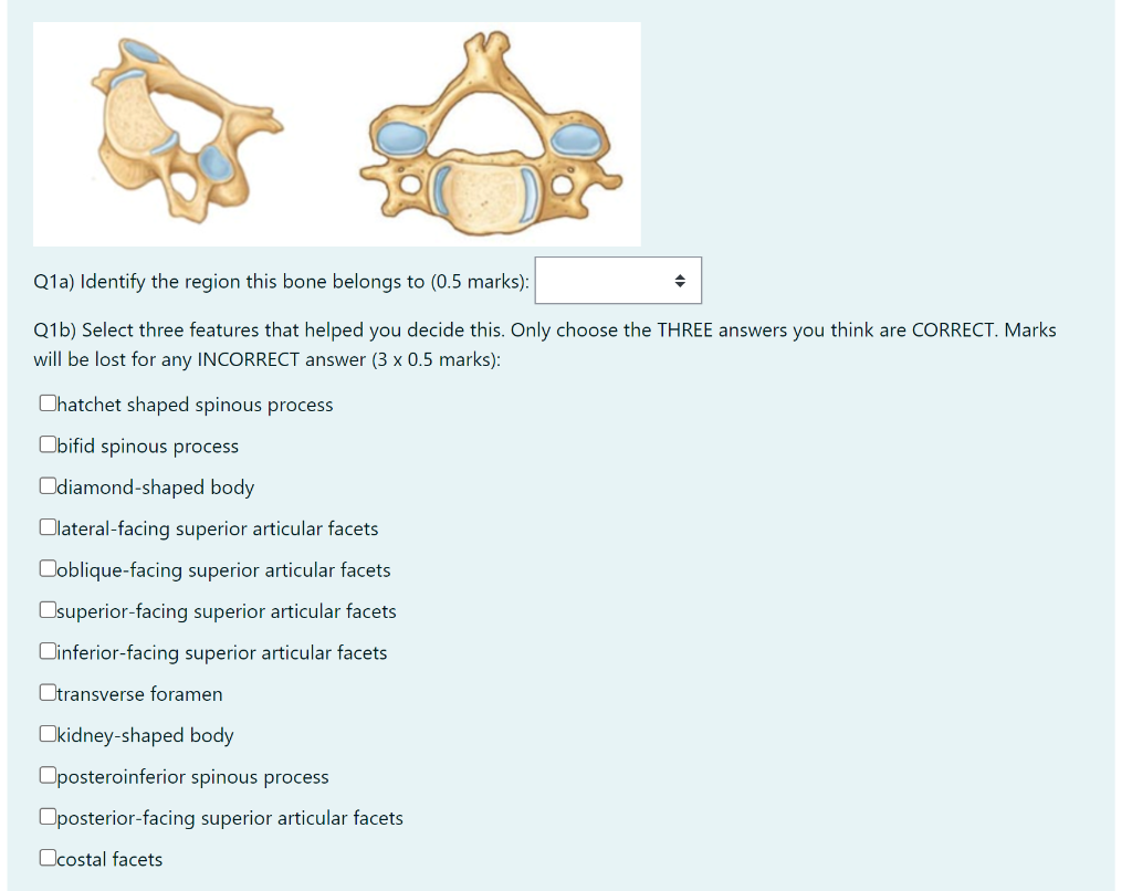 Solved Q1b) Select three features that helped you decide | Chegg.com