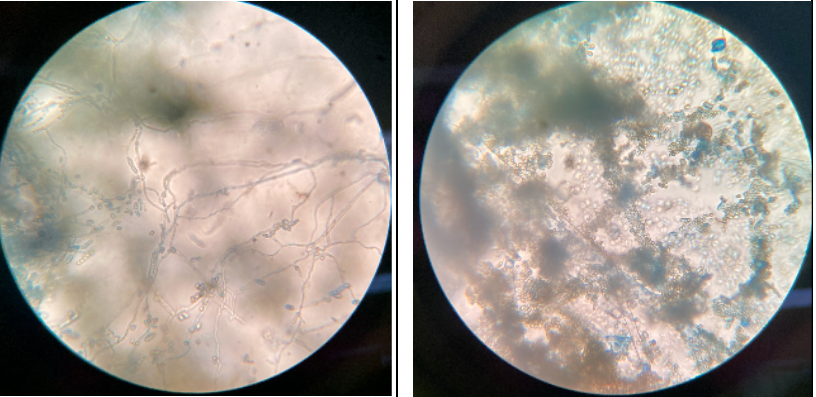 Solved 1.Image A: Based on the chart GUES what fungi does | Chegg.com
