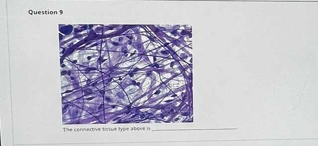 Solved Question 7 This is Question 9 The connective tissue | Chegg.com