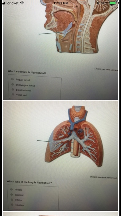 Solved 11:31 PM cricket Which structure is highlighted? | Chegg.com