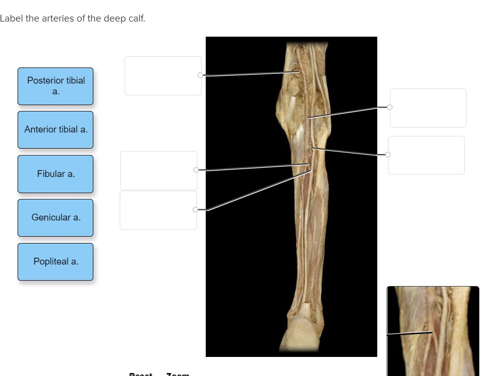 Solved Label the arteries of the deep calf. Posterior tibial | Chegg.com