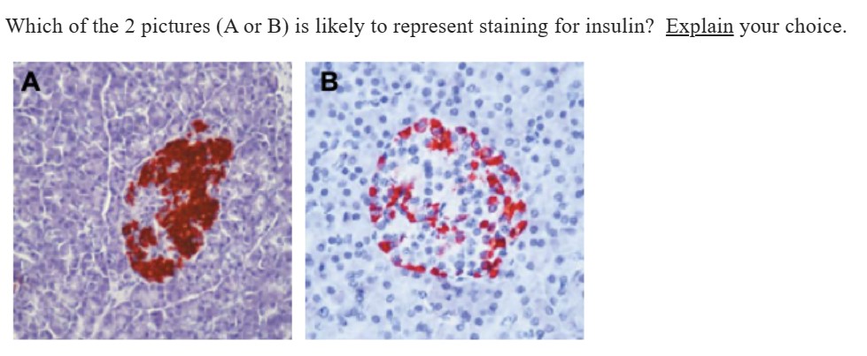 Solved Which of the 2 pictures (A or B) is likely to | Chegg.com