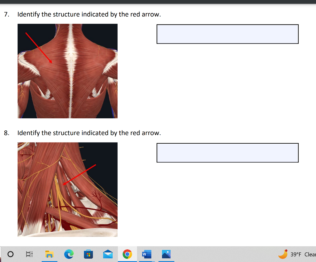 Solved 7. Identify the structure indicated by the red arrow. | Chegg.com