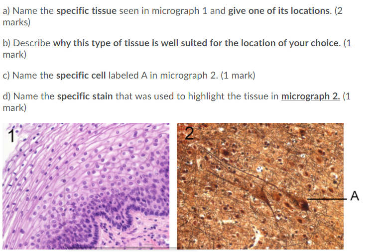 Solved a) Name the specific tissue seen in micrograph 1 and | Chegg.com