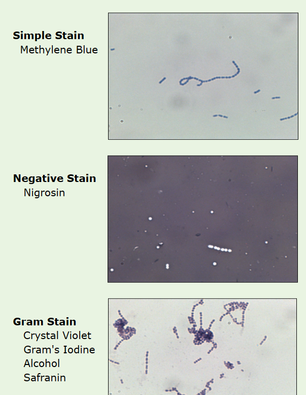 Simple Stain Methylene Blue Negative Stain Nigrosin | Chegg.com