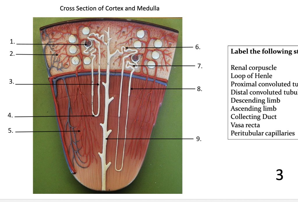 Solved Kidney Lateral View Vidnn, Crontal Dlonn I atoml | Chegg.com