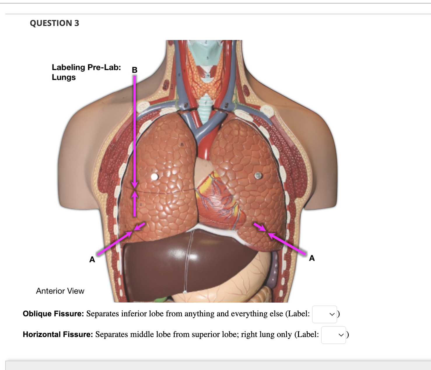 Solved QUESTION 1 Trachea: Airway; anterior to the esophagus | Chegg.com