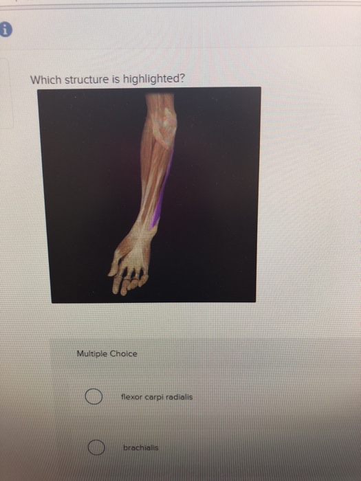 Solved 0 Which structure is highlighted? Multiple Choice | Chegg.com