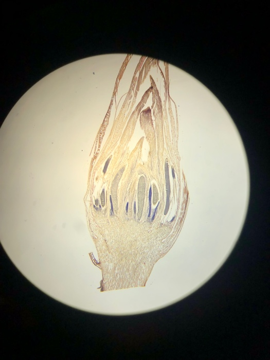 Solved Label ARCHEGONIAL Head, archegonium, And egg | Chegg.com
