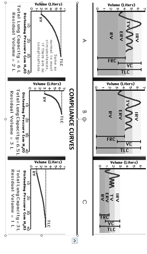 Solved Below are spirograms and compliance curves of 3 lung | Chegg.com