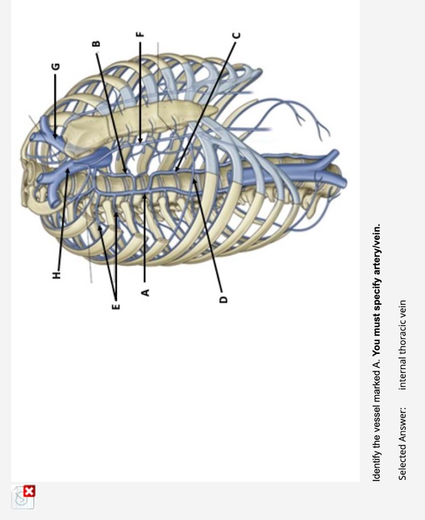 Solved Identify the vessel marked A. You must specify | Chegg.com