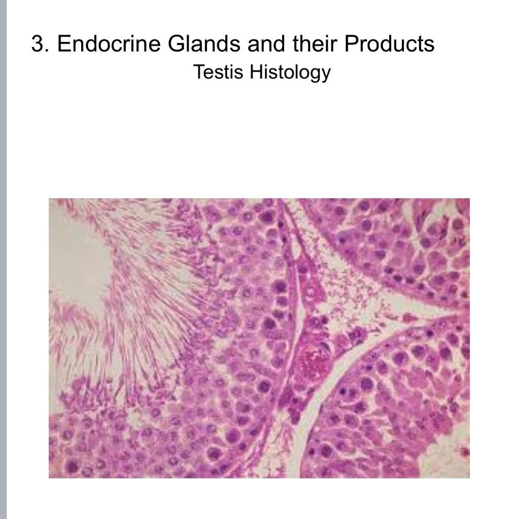 Solved 3. Endocrine Glands and their Products Testis | Chegg.com